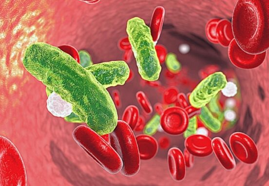 What Are The Stages Of Sepsis Ankin Law Chicago