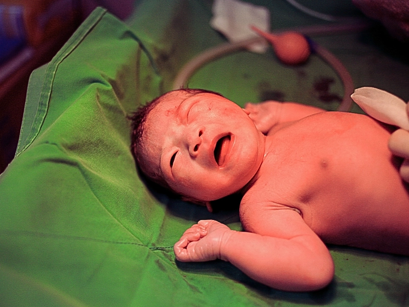 Signs of Erb's Palsy in Infants | Ankin Law | Chicago, Illinois